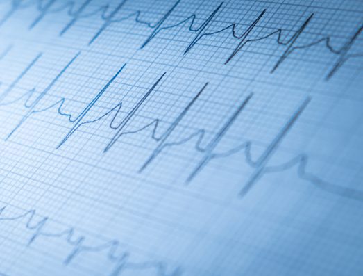 Cardiovascular Diagnosis & Treatment Services Rock Hill, SC